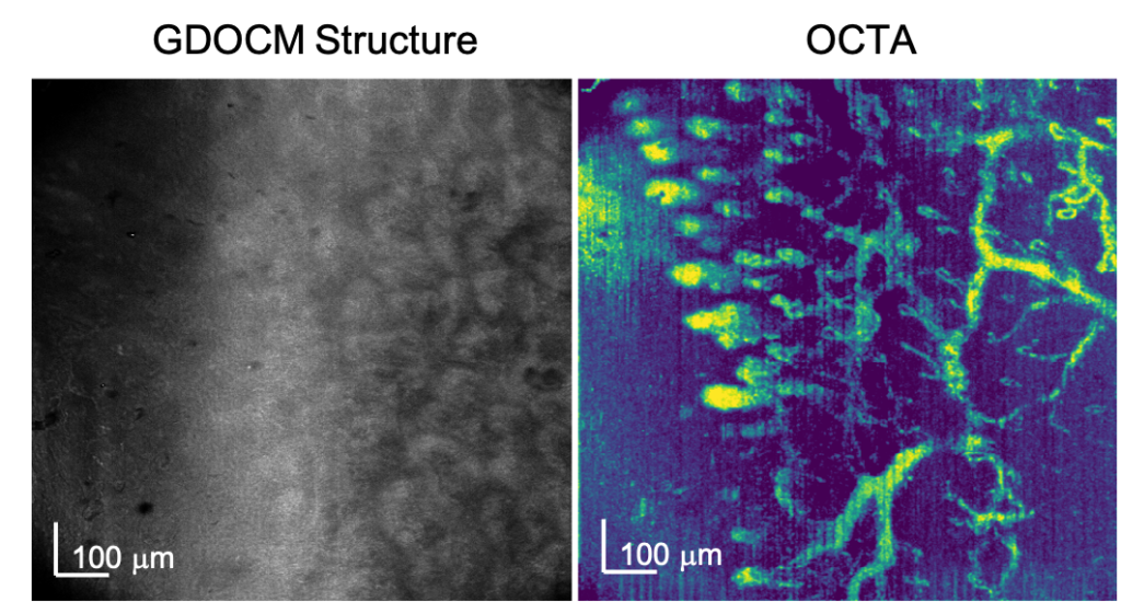 LighTopTech Corp. | OCTA